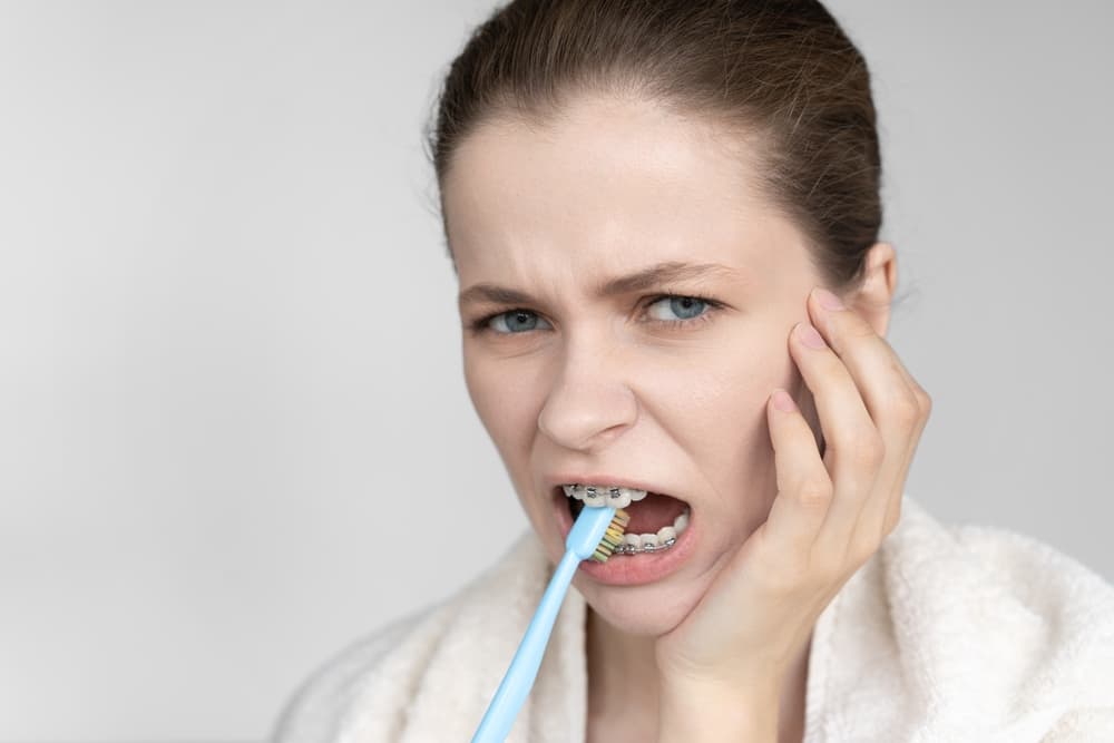 Bleeding Gums with Braces? How to Manage Them